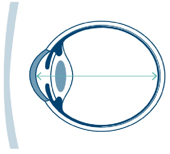 Presentamos Mycon de Rodenstock – Revista Ver+